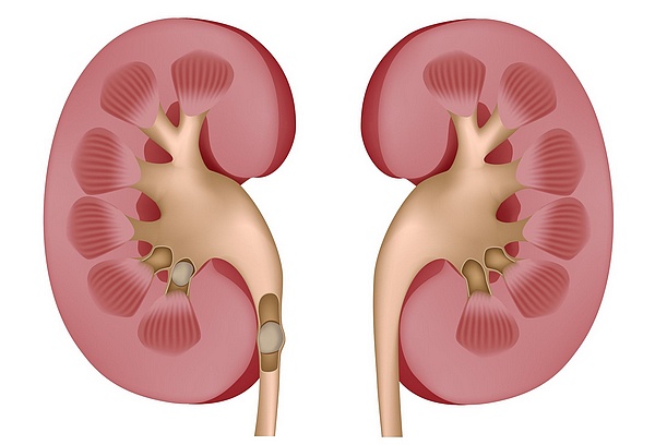El cuidado de los riñones - Salud