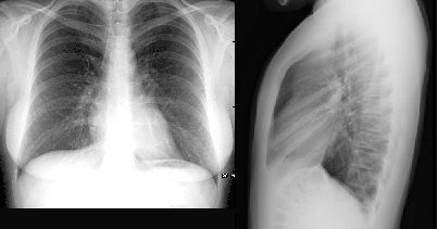 Estudo Radiográfico : ROTINA DE TÓRAX