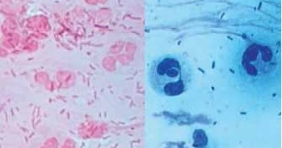[Microbiology] Atlas of Fecal Analysis | Free Medical Atlas