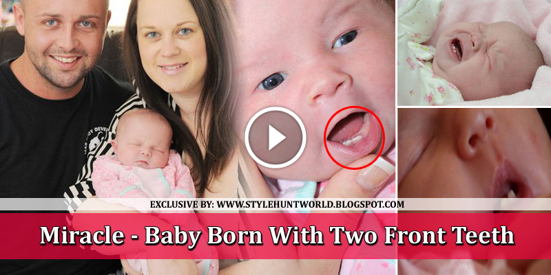 Miracle - Baby Born With Two Adorable Teeth - Style Hunt World