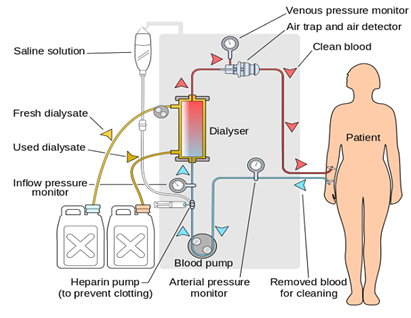 Assistência de enfermagem na Hemodiálise | Enfermagem