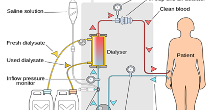 Assistência de enfermagem na Hemodiálise | Enfermagem