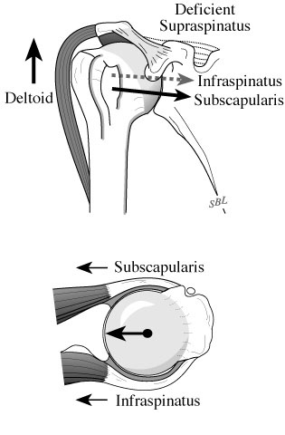 UW Shoulder and Elbow Academy: Rotator Cuff 2 - Clinical Considerations ...