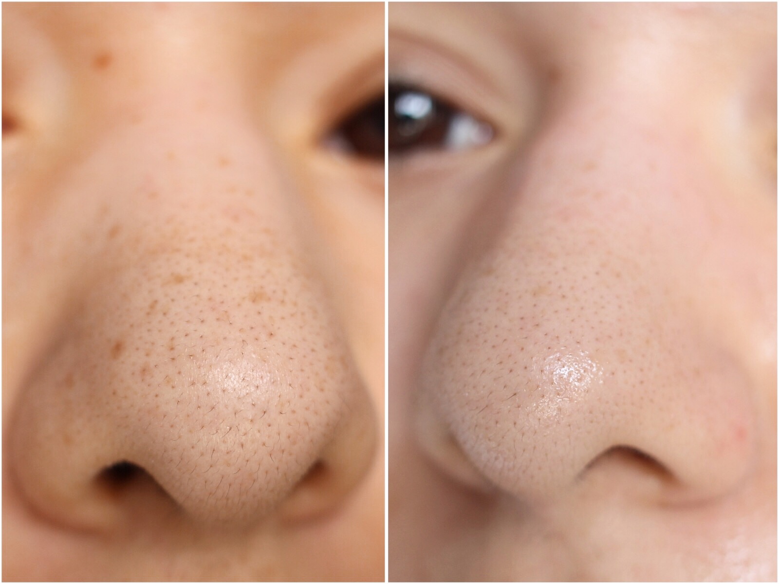 Primera Impresión | Holika Holika Pig Nose Clear Blackhead 3-Step Kit ...