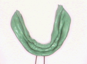 Dentistry and Medicine: Elastic Impression Materials-Elastomers ...