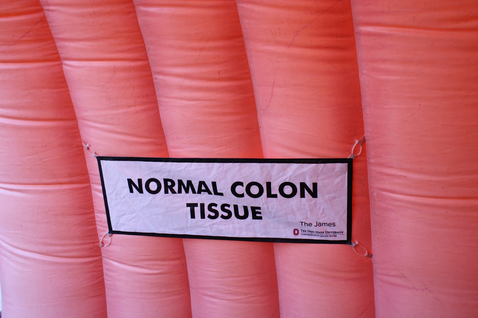 Bg By Christina Uc Take Steps For Crohns And Colitis Walk