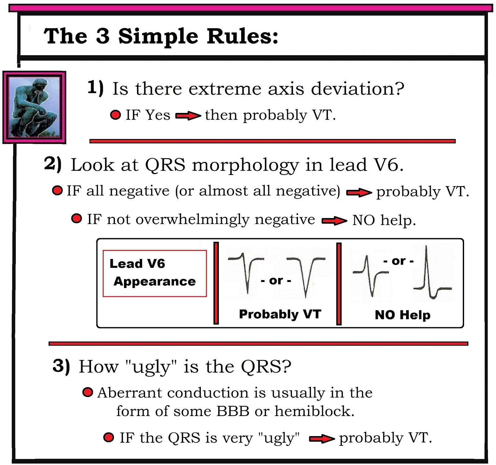 ECG Interpretation: ECG Blog #42: What Criteria? — VT vs Aberrancy?