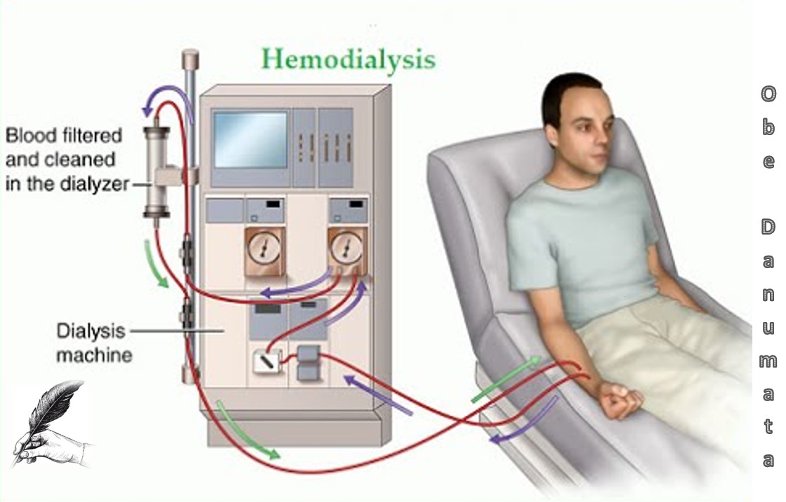 What is Dialysis?