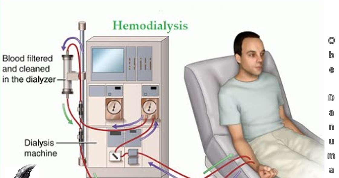 What is Dialysis?