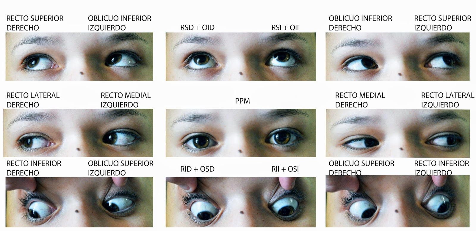 TM Oftalmología: Motilidad Ocular