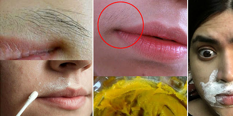 How To Remove Facial Hair With One Miracle Ingredient - The Stylish Life