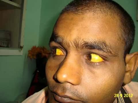 Ridiculously confortable : PERIPHERAL SIGNS