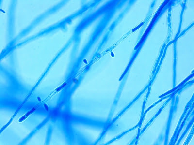 Fun With Microbiology (What's Buggin' You?): Trichophyton tonsurans