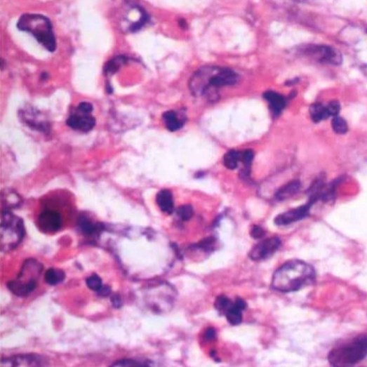 PATOLOGÍA BUCAL: Patología General "Lesión y adaptación celular"