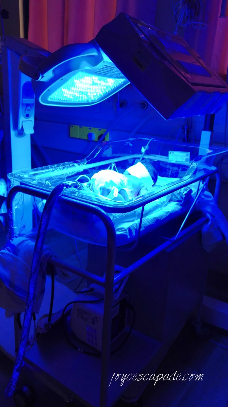 Dealing with Neonatal Jaundice - Joy 'N' Escapade