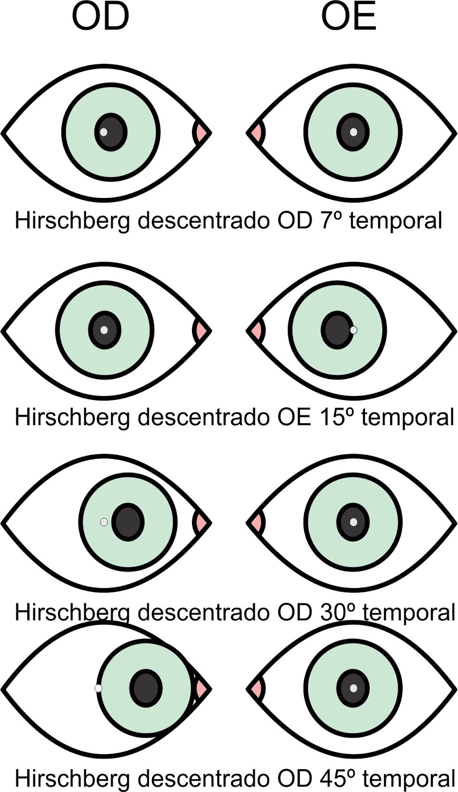 Optometria in Foco: Teste de Hirschberg