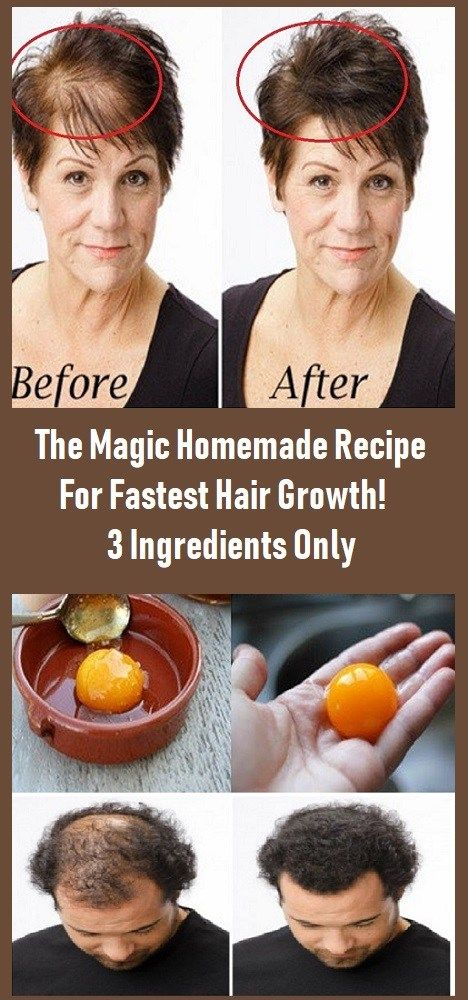 The Magic Homemade Recipe For Fastest Hair Growth! 3 Ingredients Only ...