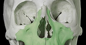 Medical Crack: THE MAXILLA