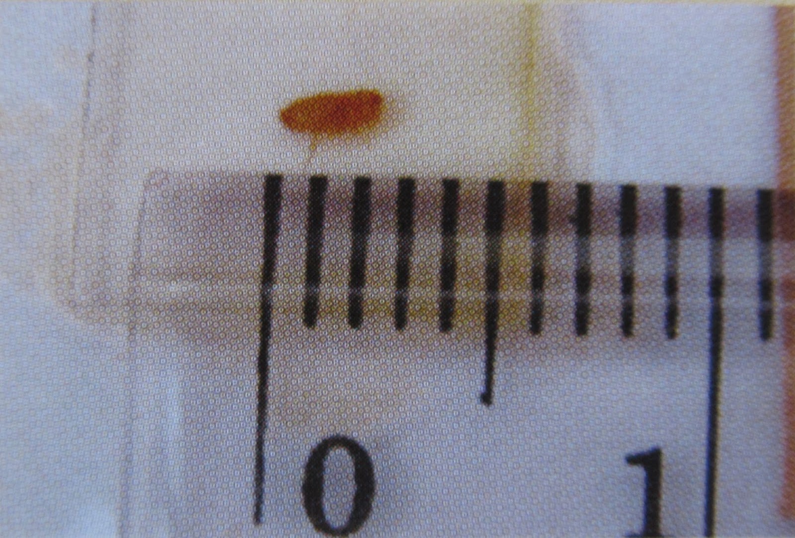 Pinjal Sebagai Salah Satu Vektor Penyakit - LIFE IS A GIFT