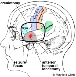 Healthcare, etc.: Joel Winer, M.D.:The Practice of Neurosurgery