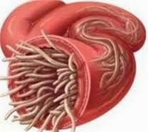 PARASITOLOGÍA: OXIUROS