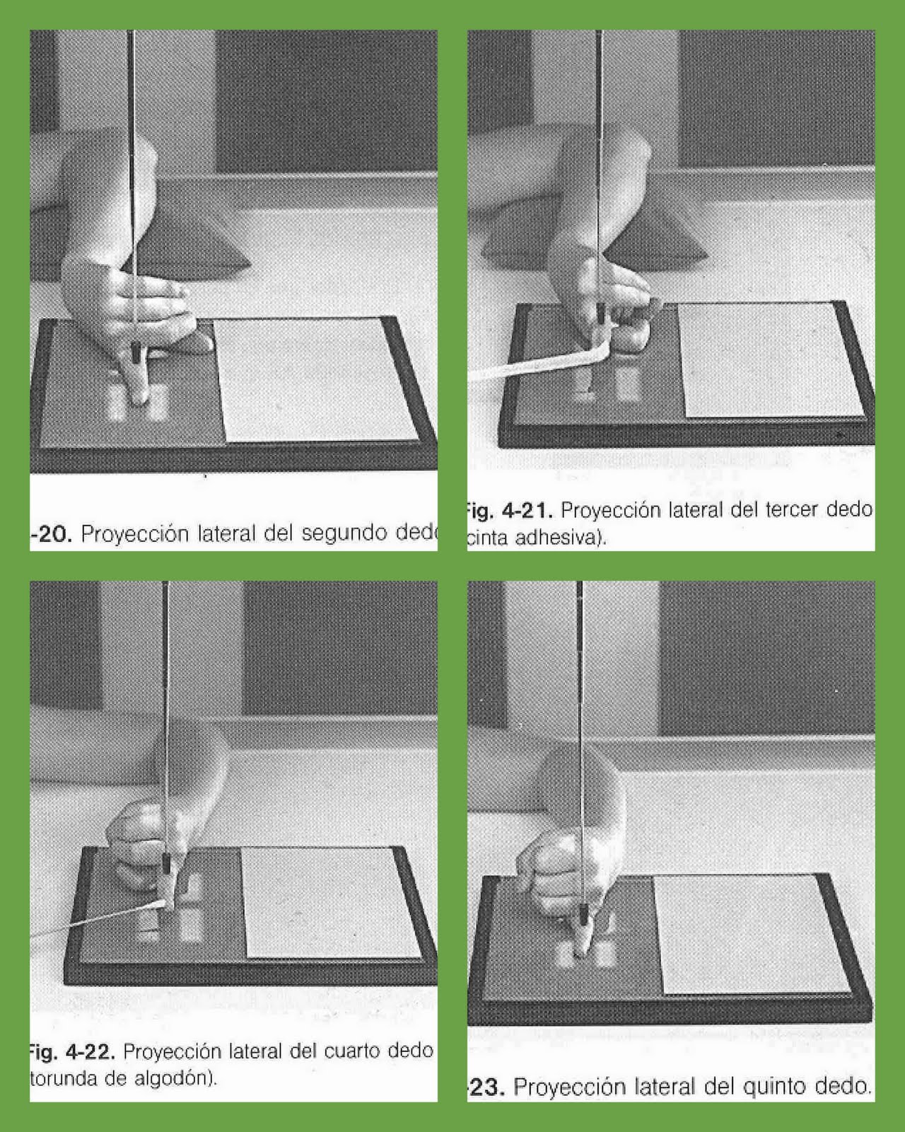 tecradiologos: DEDOS: SEGUNDO A QUINTO