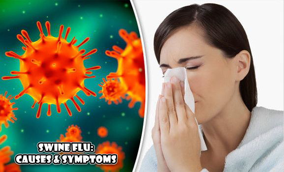 Swine flu: Causes & Symptoms