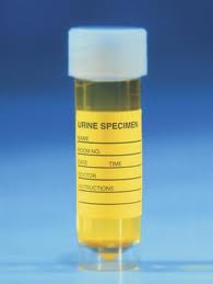 Periksa Protein dalam Urin /Artikel-Dokter-Anda/ Periksa Laboratorium Anda