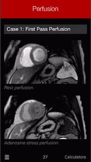 Radiologia en Internet: CMR Guide and CMR Pocket Guide