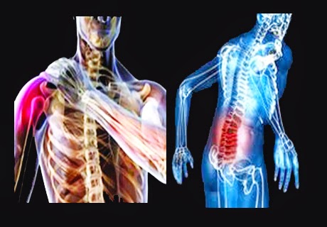 INSULAR FITNESS: 10 DOENÇAS RELACIONADAS AO TRABALHO. LER E DORT.