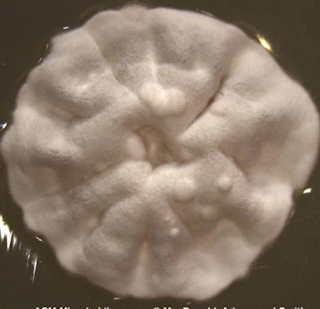 aldair-latournerie: MORFOLOGÍA DE COLONIAS