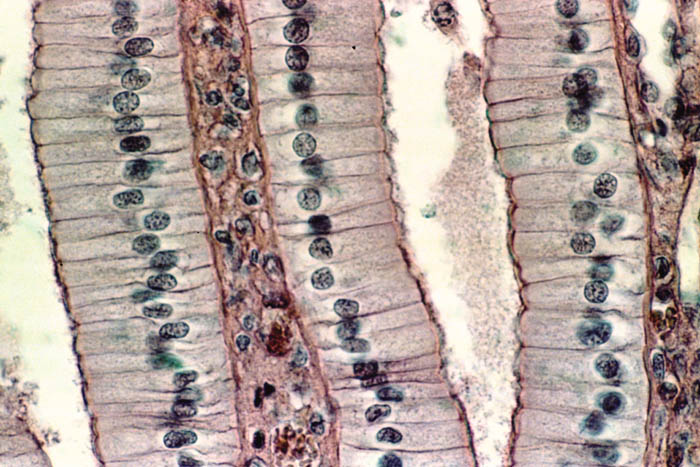 Histología en Imágenes : EPITELIO SIMPLE COLUMNAR