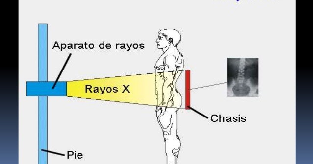 INTRODUCCIÓN A LA RADIOLOGÍA: EXÁMENES RADIOGRÁFICOS SIMPLES