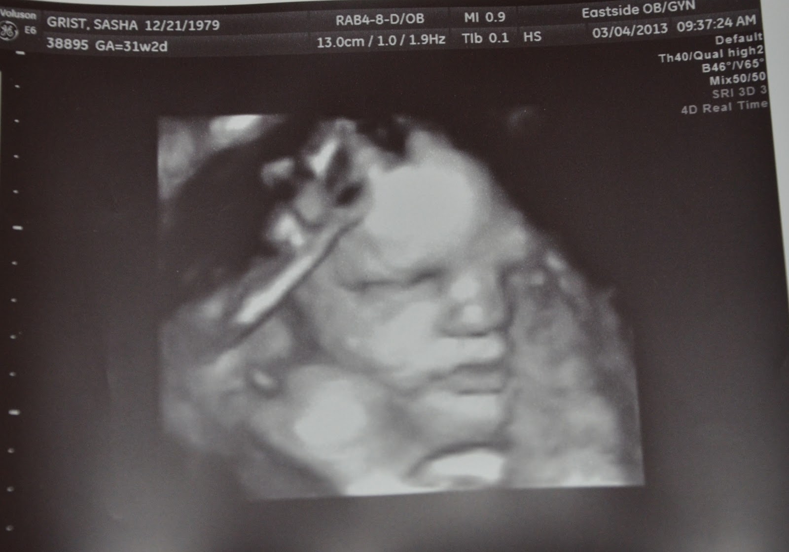 And Then There Were Five!: 31 Weeks Ultrasound