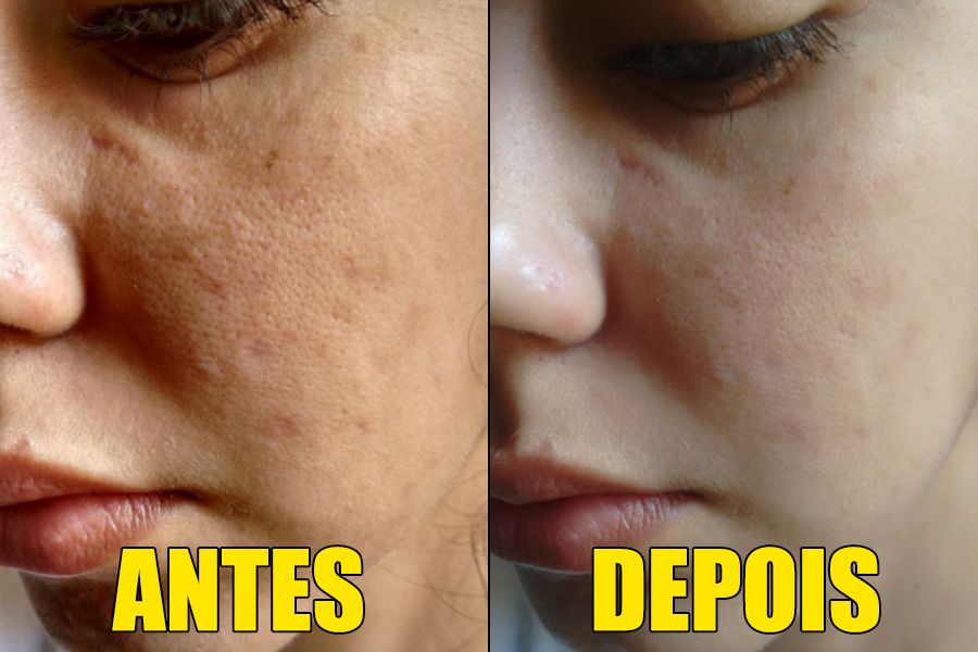 Deusiane Mariah: Luminus Skin Para a Pele Funciona? Resultado com 1 mês