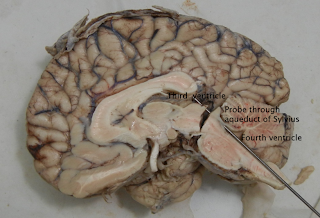 into the roots: Basic neuroanatomy