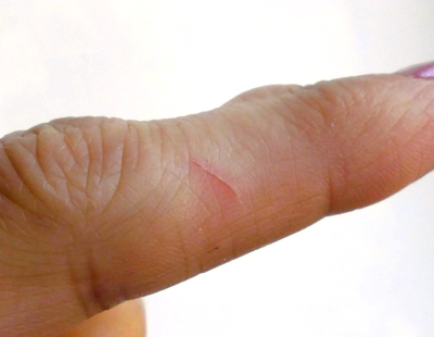 Searching in my dreams: More mysterious scratches