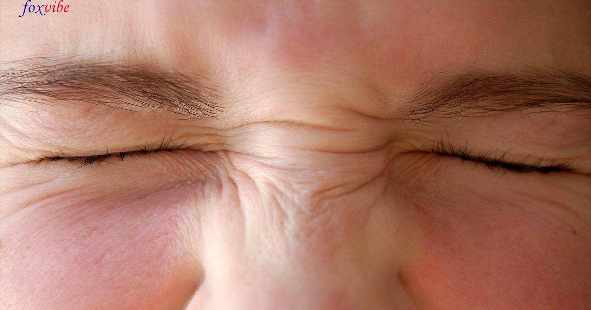 PREMATURE WRINKLES/AGING-CAUSES AND PREVENTION!