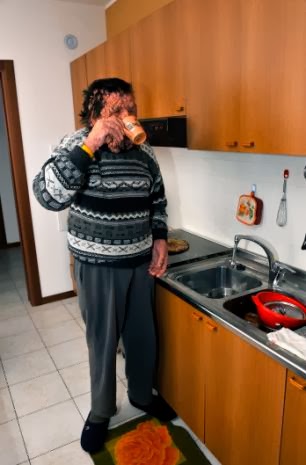 Manny360: [FULL PHOTOS] Disfigured Man who was Held and Kissed by Pope ...