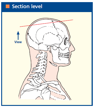 Head sectional anatomy