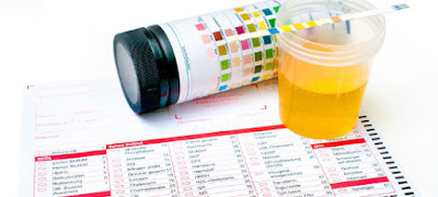 At Home STD Test: Home STD Testing Kits CVS,Walgreens,Walmart,Rite Aid