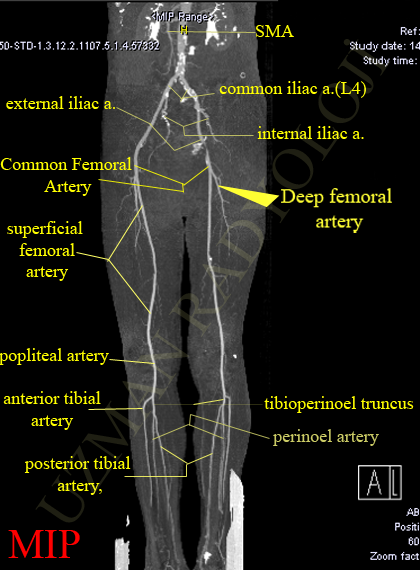 BT ANJİOGRAFİ (CT ANGIOGRAPHY) PROTOKOLLERİ-Hazırlık aşamasında
