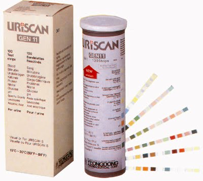 Клиническая Лаборатория: Uriscan Optima Анализатор Мочи (YD Diagnostics)