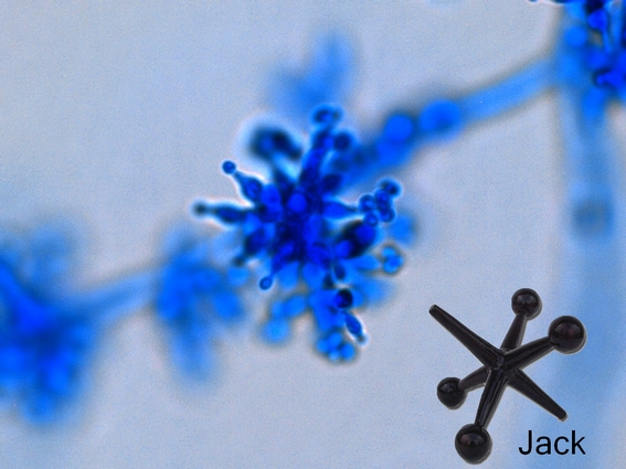 Fun With Microbiology (What's Buggin' You?): Trichoderma species
