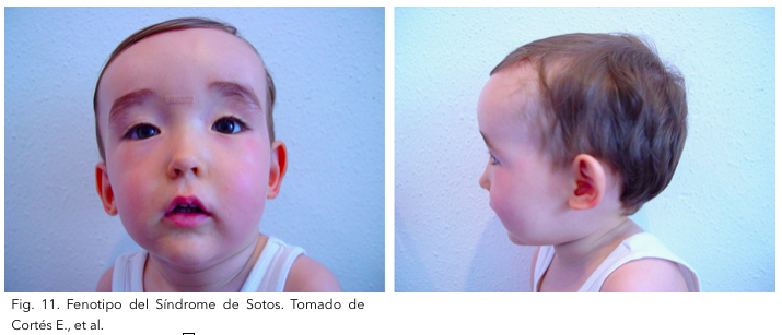 RED LATINOAMERICANA DE PEDIATRÍA Y NEONATOLOGÍA: Malformaciones ...