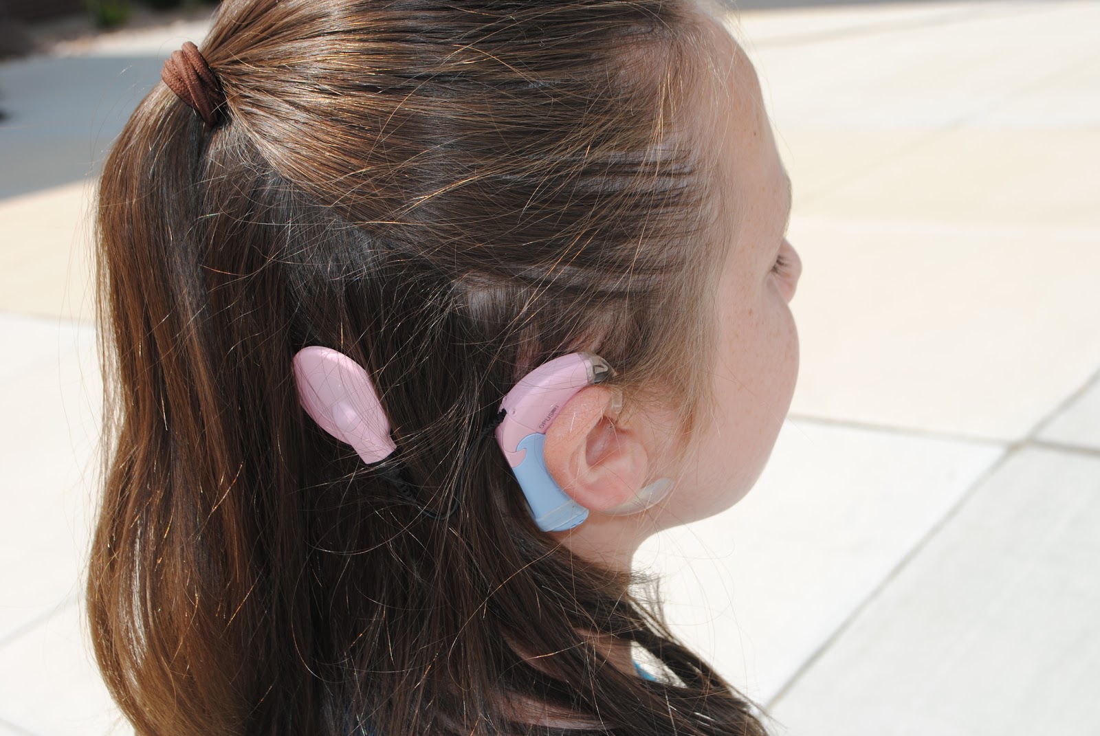 Keep Moving Ahead!: Emily's Cochlear implant journey...