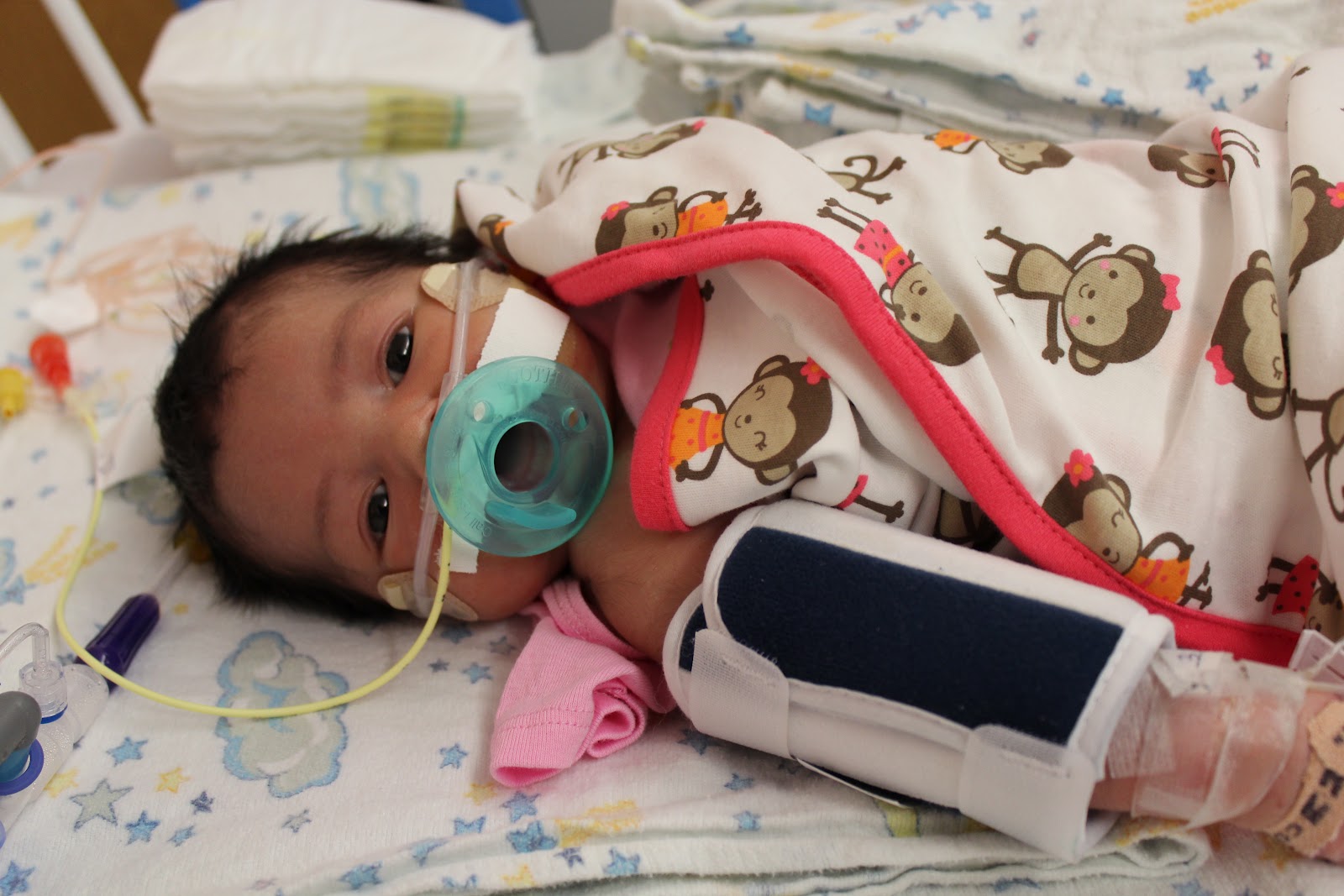 Baby Luna's CDH Story: Big Baby Girl Crib