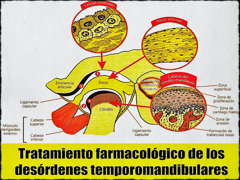 ATM: Tratamiento farmacológico de los desórdenes temporomandibulares