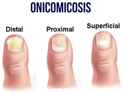 Dra. Anabel Manzone. Dermatóloga.: noviembre 2016