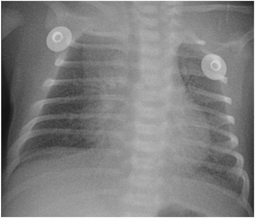 Pediatria ISSSTE Mty: DIAGNOSTICOS DIFERENCIALES??? CHRISTIAN RIOS